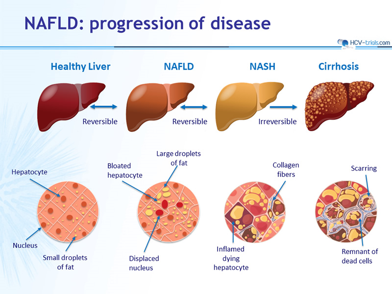 HCV Trials A Regularly Updated Website With All Most Recent HCV Trials A Regularly Updated Website With All Most Recent